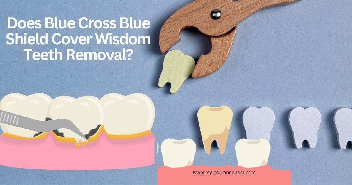 Does Blue Cross Blue Shield Cover Wisdom Teeth Removal?